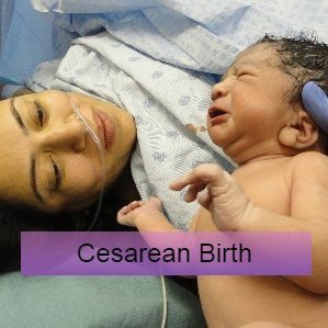 Research & Guidance on Caesarean Birth - Big Birthas